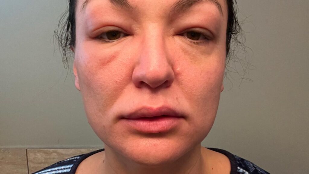 Resilience in Motion