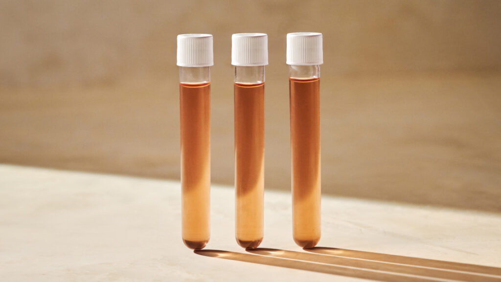 Normal vs. Optimal Lab Ranges: Why the Difference Matters